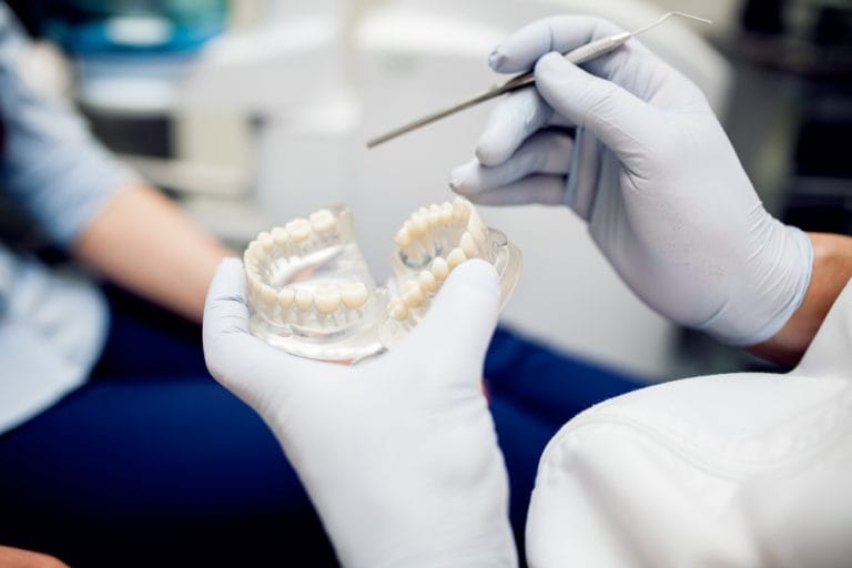 What Are Screwless Dental Implants? Pros, Cons, and Safety Insights ...