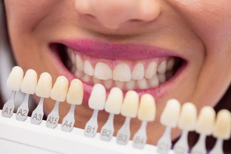 Can Teeth Whitening Damage Enamel? Understanding Risks & Safe Practices ...