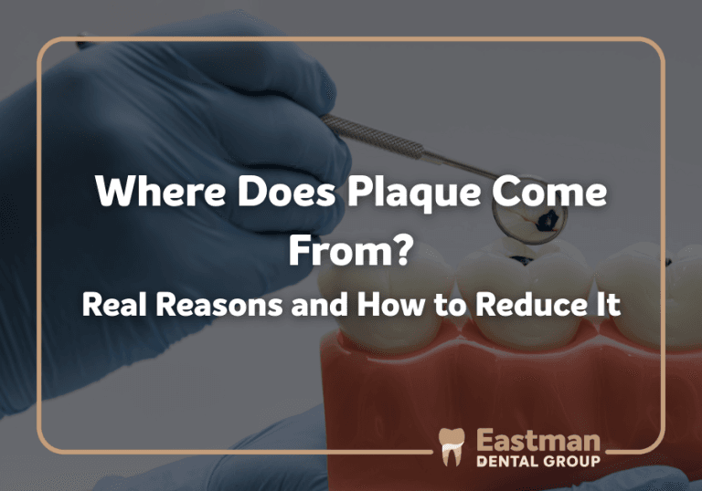 Where Does Plaque Come From | Eastman Dental Clinic Beausejour